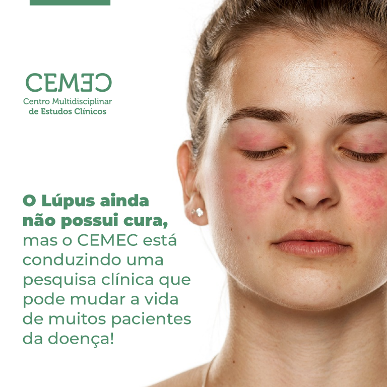 3 perguntas e respostas sobre o Lúpus! | CEMEC